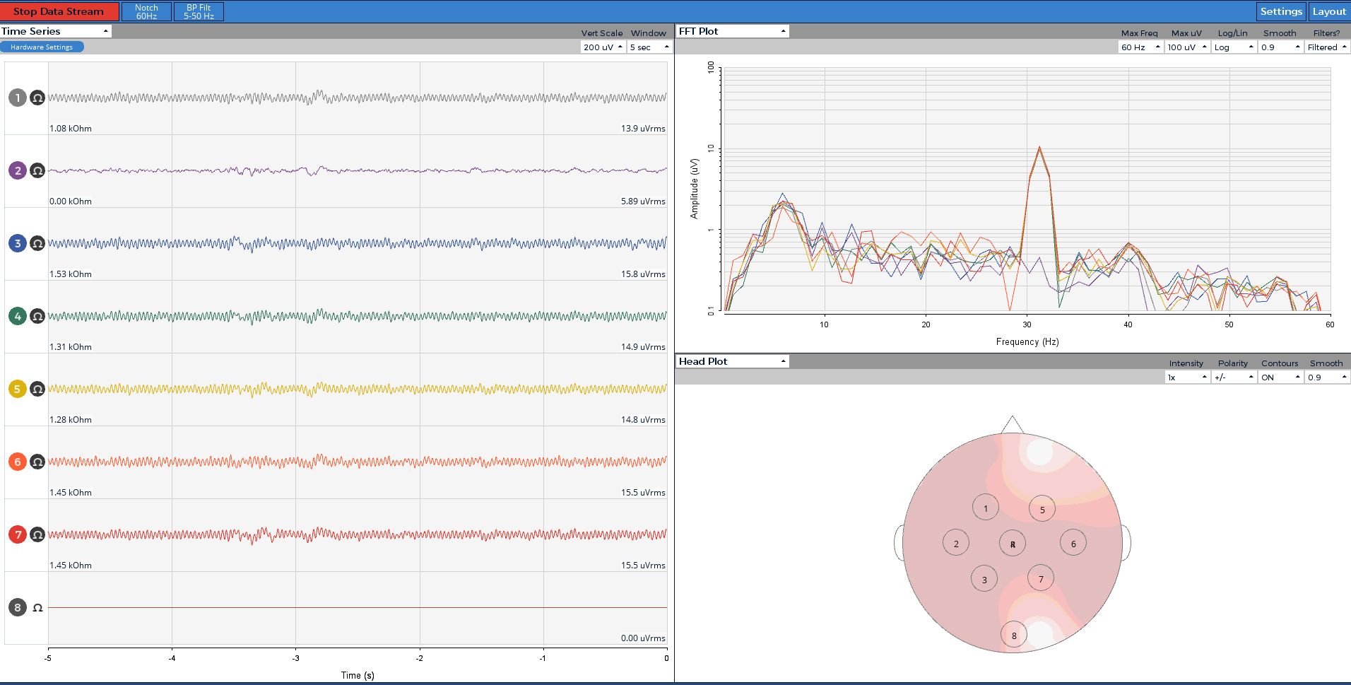 Active electrodes for OpenBCI – 2nd part | OpenBCI Community