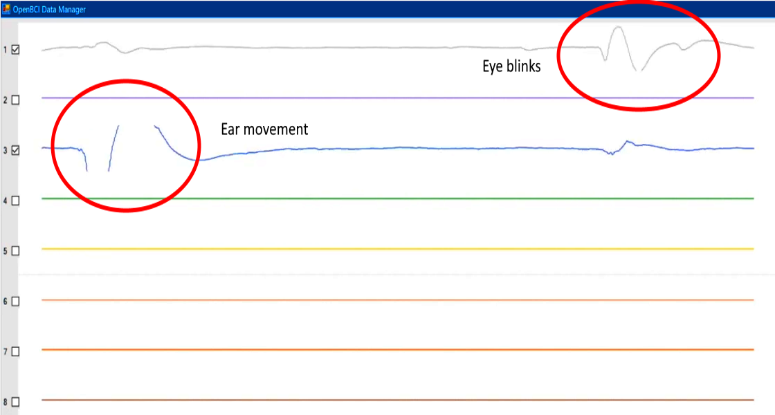 Synthesized speech with OpenBCI system | OpenBCI Community