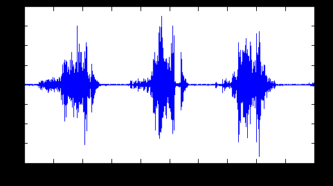 OPENBCI Discovery Program : MUSE | OpenBCI Community