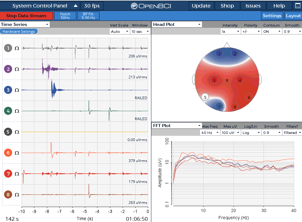 FP1 and FP2 always RAILED — OpenBCI Forum