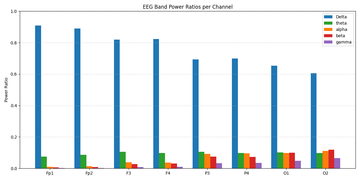 EEG data analysis, delta band strongest — OpenBCI Forum