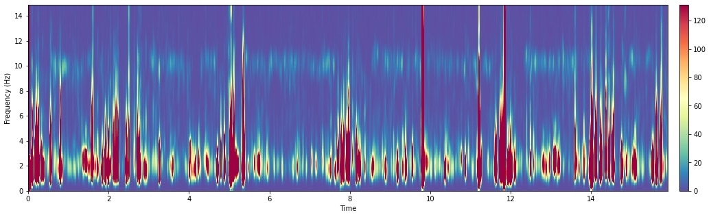 High low-frequency energy in EEG signal — OpenBCI Forum