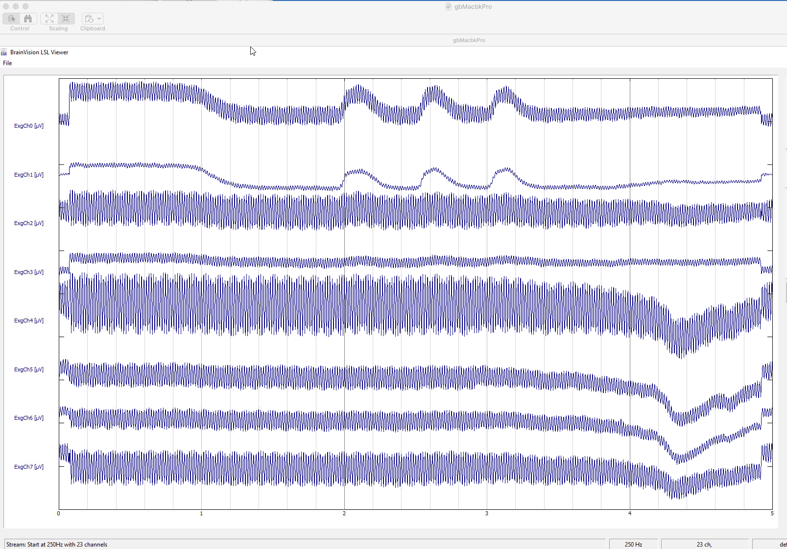 My Cyton+Daisy raw data looks broken? — OpenBCI Forum