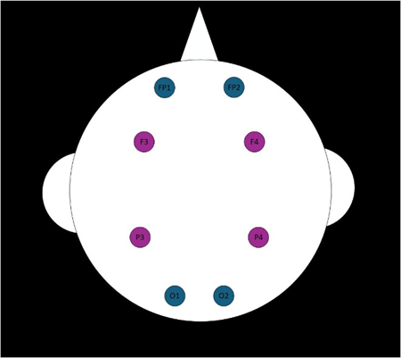 EEG data analysis, delta band strongest — OpenBCI Forum