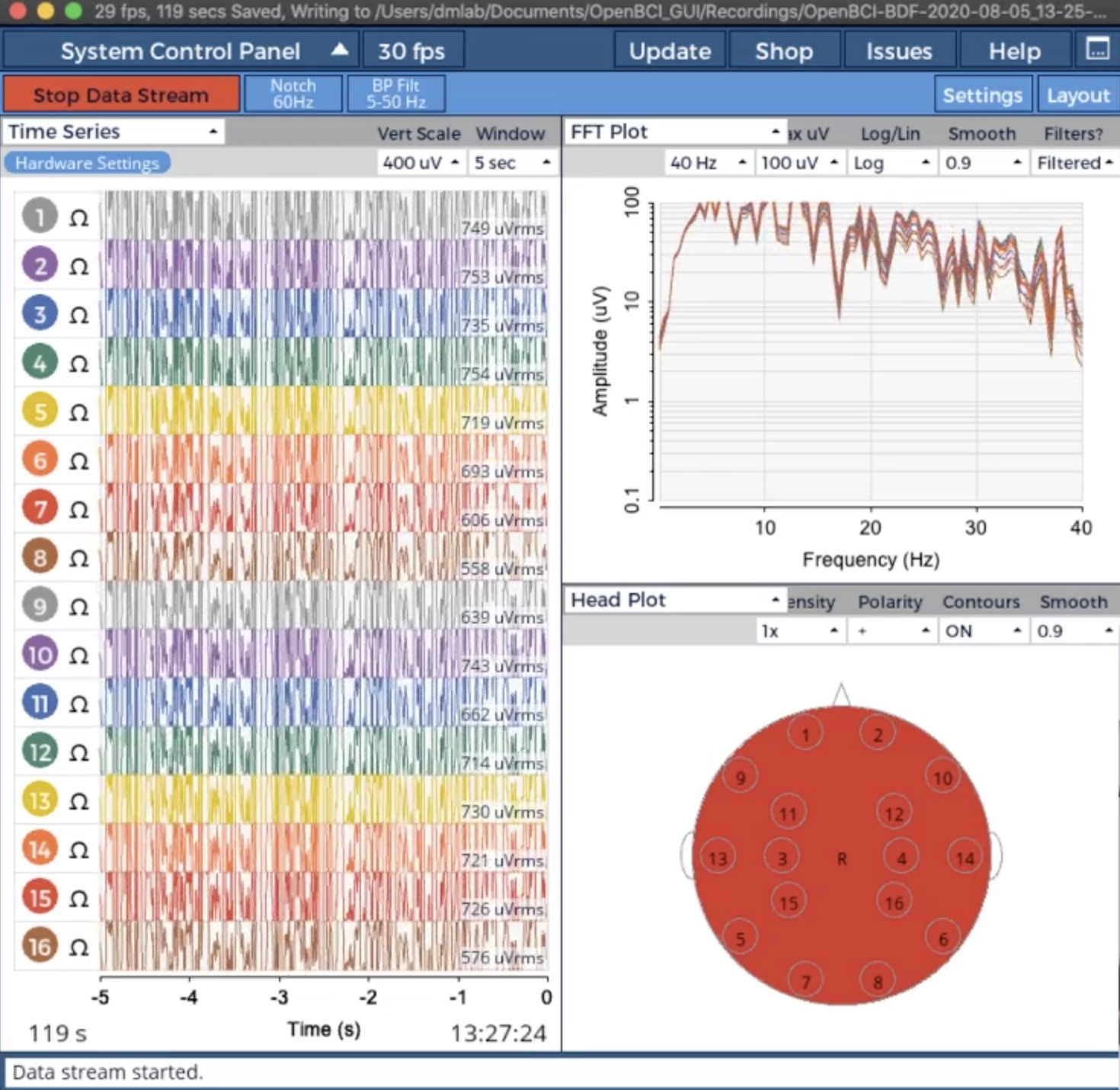 amplitude of the scalp EEG?? — OpenBCI Forum