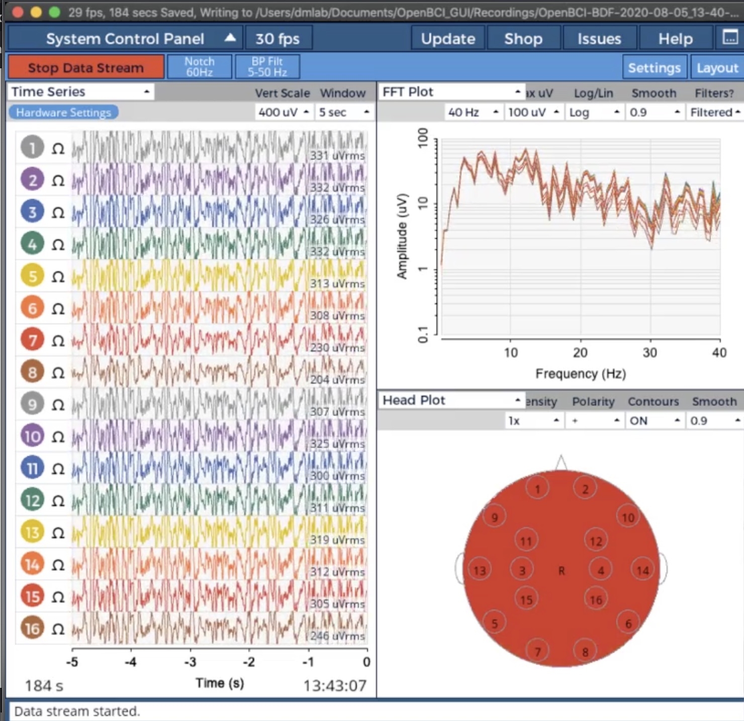 amplitude of the scalp EEG?? — OpenBCI Forum